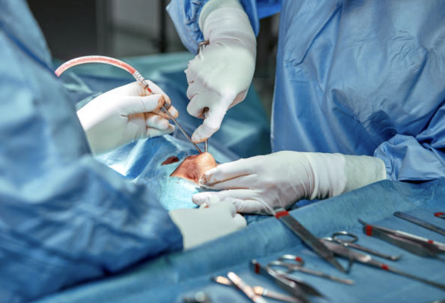 Rhinology: Radiofrequency Ablation and Coblation - STEPS